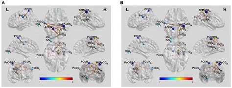 Frontiers Aberrant Baseline Brain Activity And Disrupted Functional Connectivity In Patients