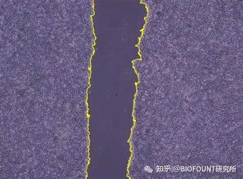 细胞迁移与侵袭实验（以 Transwell 实验为例）及划痕实验介绍 知乎