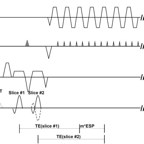 the simultaneous 2 band interleaved epi pulse sequence with te
