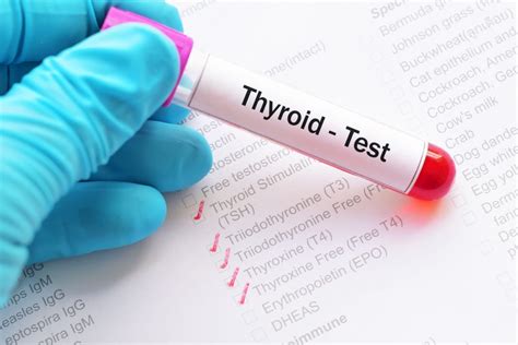 Thyroid Function Tests Explained Healthengine Blog