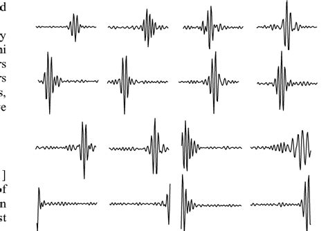 A Subset Of The Basis Vectors Learned By Ica Which Are Localized In Download Scientific Diagram