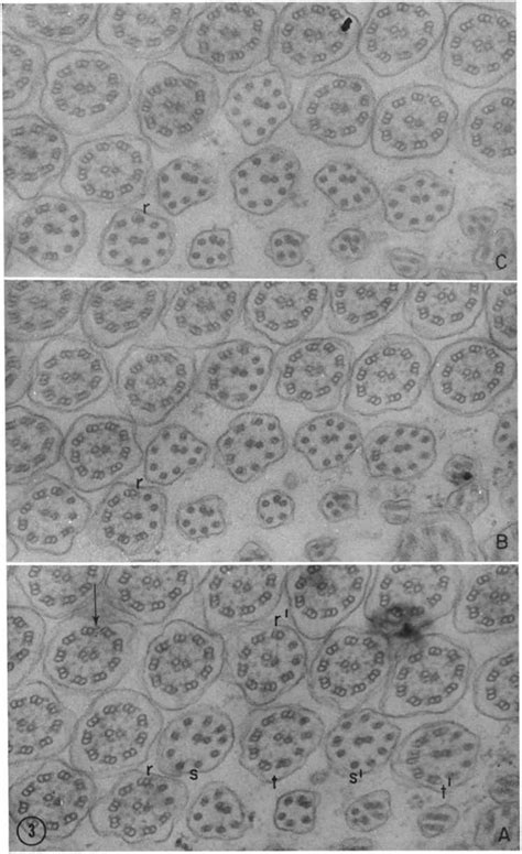 Adjacent Serial Sections Of Control Cilia Showing Images Used In Download Scientific Diagram