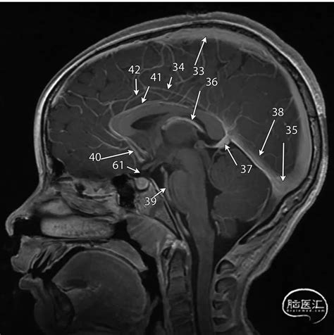 正常人脑中线的大体解剖，你认识多少？ 脑医汇