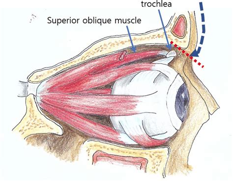 Sagittal View Of Extraocular Muscles In Right Orbit The Range Of Download Scientific Diagram