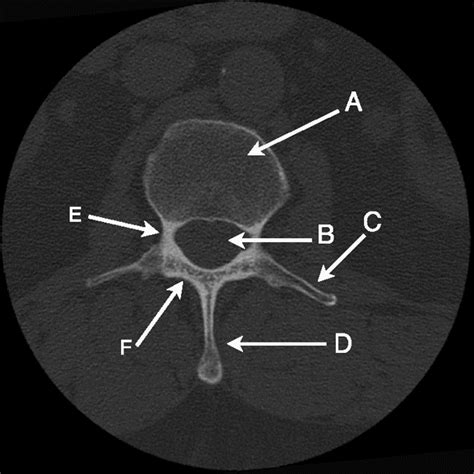 Diagram Of Axial C Spine Quizlet