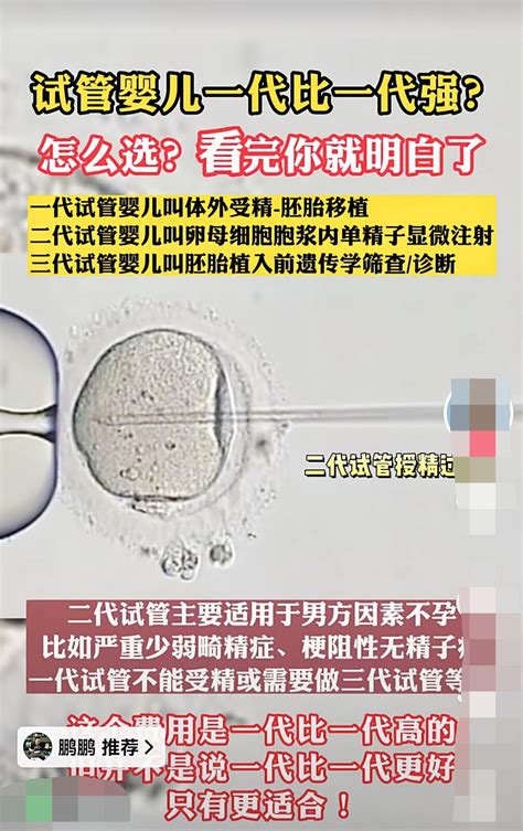 如何选择做几代试管婴儿试管婴儿试管婴儿治疗介绍 好大夫在线