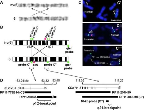 Schematic Representation Of Breakpoints On Chromosome 6 A Karyotyping Download Scientific