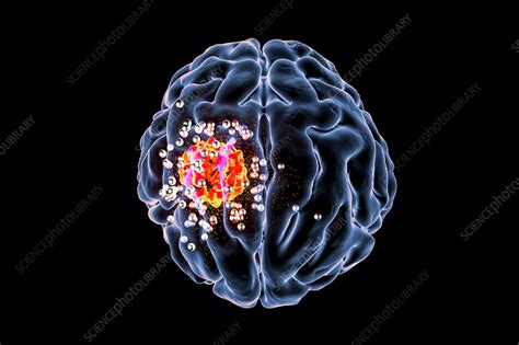 Nanotechnology Cancer Treatment Illustration Stock Image F0192467