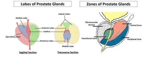 Prostate Gland Health Matters What You Need To Know