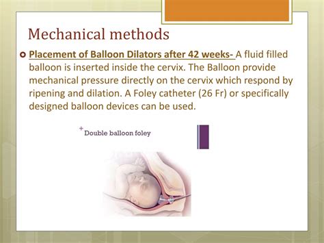 Induction Of Labour PPTX