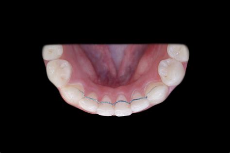 Memotain Kieferorthopädische Fachpraxis Dr Visse Theising