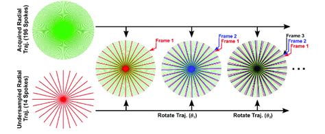Radial Undersampling Using Uniform Angle Rotating Radial Trajectories Download Scientific