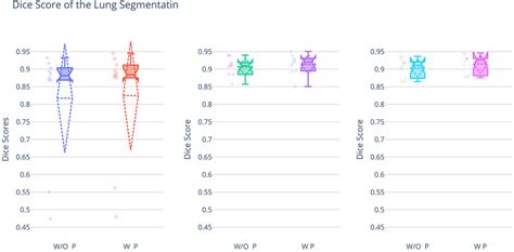 Dice Scores Of The Lung Segmentation Using Different Pre Processing And Download Scientific