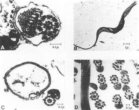 A Cross Section Through A Flagellum B Detergent Extracted
