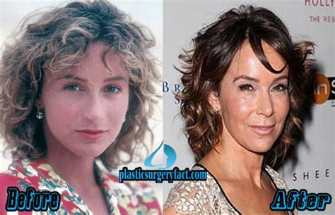 Jennifer Grey Nose Job Jennifer Grey Before And After Nose Job