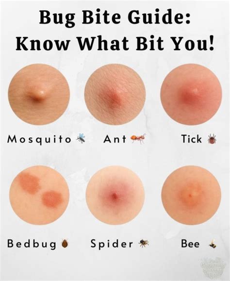 Now You Can See What Bit You 🐍🐝🐜🪲🦗🕷🪳🦂 In 2025 Insect Bites Ant