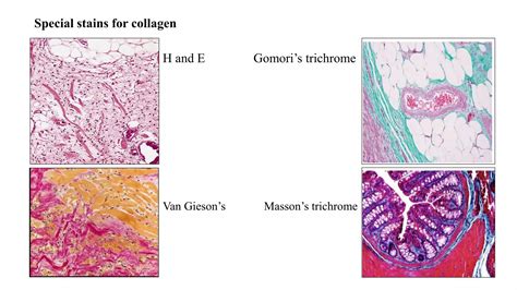 Extracellular Matrix Ppt