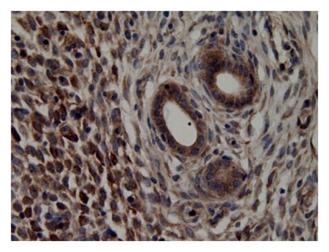 The Expression Of Erβ In Eutopic Endometrium Dab Stain ×400 A