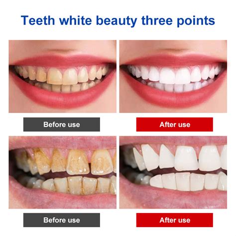 Professional Whitening Toothpaste Whiten Teeth Mint Toothpaste 200g