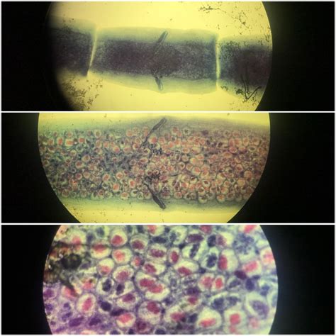 Dipylidium 4x And 10x Diagram Quizlet