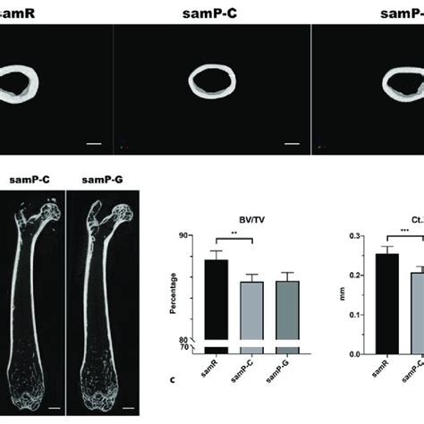 micro ct and quantification of bone microarchitecture in the femoral