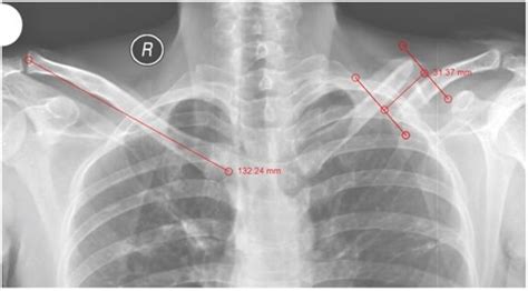 Pre Operative Radiological Assessment Download Scientific Diagram
