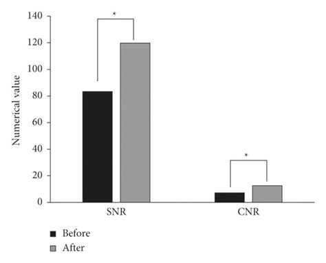 Evaluation Of Noise Reduction Effect Note Suggests The Difference Download Scientific