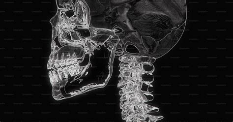 인간 두개골의 측면 X Ray 이미지 사진 Unsplash의 건강 이미지