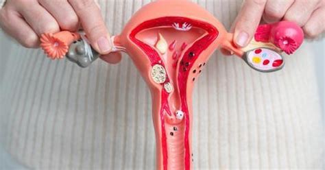 자궁경부암 전 단계 ‘자궁경부이형성증 어떻게 치료하나