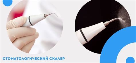 Ультразвуковая чистка зубов: цены в Москве на ультразвук для пациентов ...