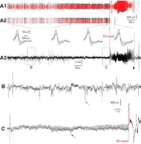 Preictal Activity Of Subicular Ca1 And Dentate Gyrus Principal Neurons In The Dorsal
