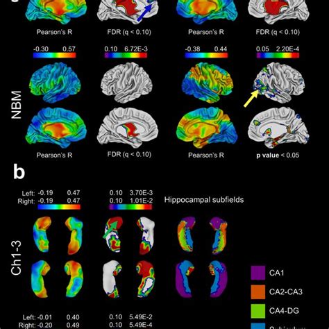 Using Transcriptomics To Explain Neuroimaging Correlations A Coloured Download Scientific