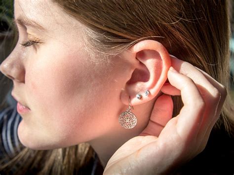 How Do I Get My Ears To Stop Itching