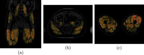 Exemplary Visualization Of Voxel Wise Texture Feature Download Scientific Diagram