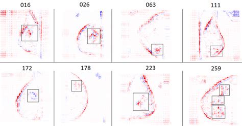 We Used The Innvestigate Library Deep Taylor Decomposition Method To