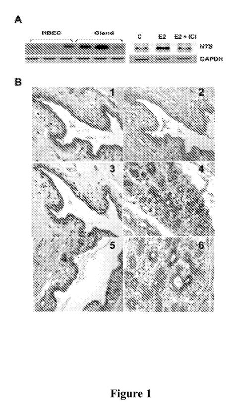 Methods For Treating Breast Cancer With Inhibitors Of Neurotensin Methods For Treating Breast Cancer With Inhibitors Of Neurotensin