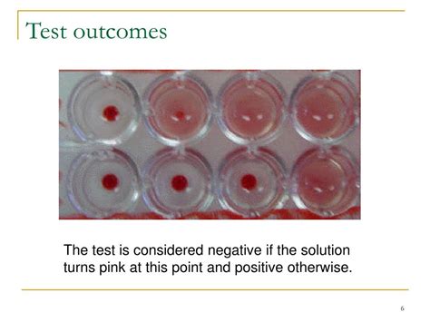 PPT Complement Fixation Test PowerPoint Presentation Free Download ID