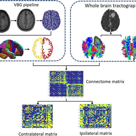 Diagram Shows Workflow For Structural Network Construction Whole‐brain