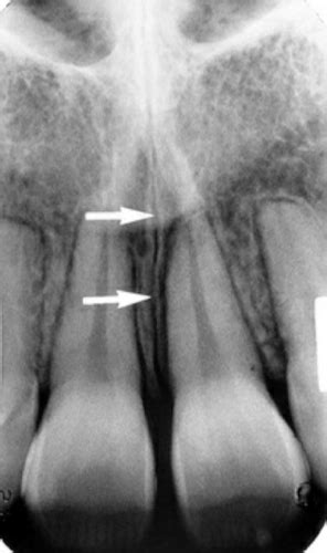 9 Radiology Considerations Flashcards Quizlet