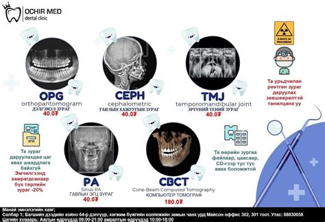 Ochir 👩🏻‍⚕️Төв салбар бүх төрлийн рентген оношлогоо хийж байна Үүнд