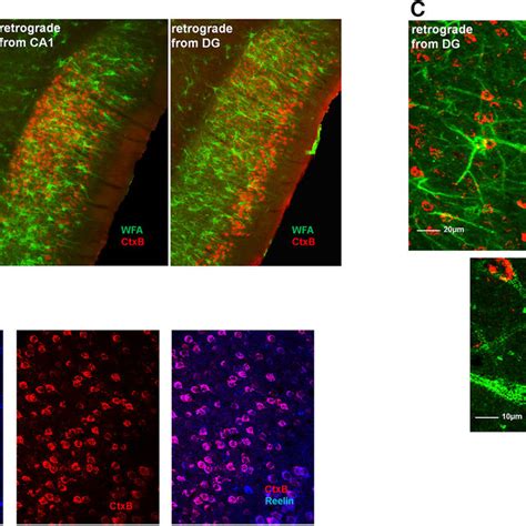 Retrograde Tracing Reveal Projecting Neurons From Mec To Hippocampus