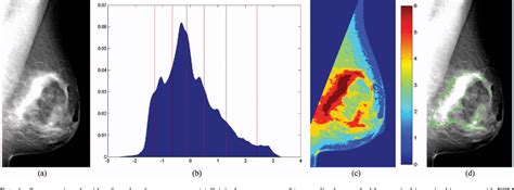 Figure 6 From Estimation Of Breast Percent Density In Raw And Processed
