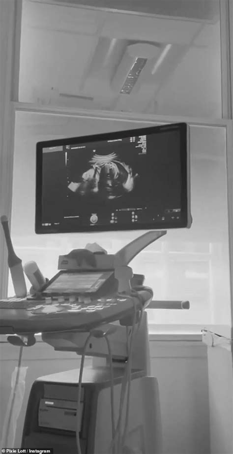 Pregnant Pixie Lott Showcases Her Growing Bump In A Black Dress As She