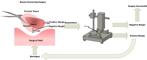 Sub Terahertz Waveguide Iris Probe For Ex Vivo Breast Cancer Tumor