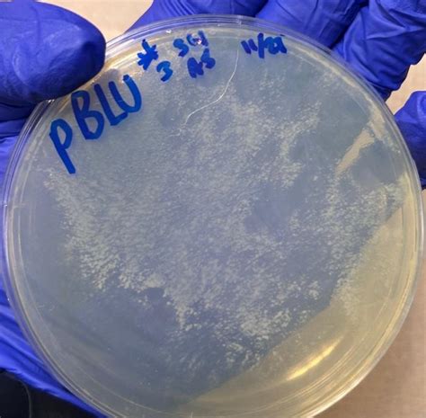 Solved 2 What Are The 2 Major Features Of Plasmid 0 5 3