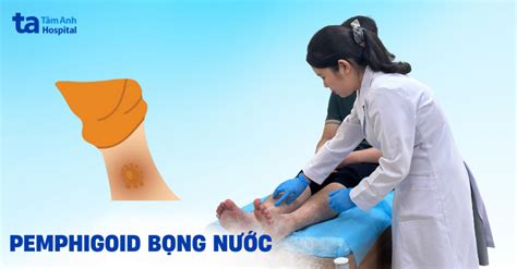 Pemphigoid Bọng Nước Nguyên Nhân Triệu Chứng Cách điều Trị