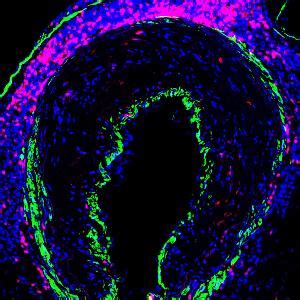 T Cells And Atherosclerosis The Good The Bad And The LMU Munich
