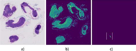 Figure 1 From Imbalanced Histopathology Image Classification Using Deep