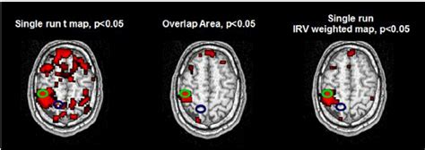 Qualitative Evaluation Of Functional Activation Maps Axial Anatomical Download Scientific