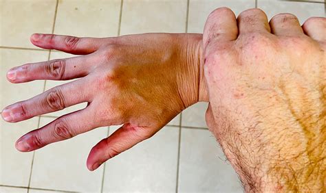 Taking Action For Sexual Assault And Sexual Battery Sexual Harassment Lawyers Palo Alto